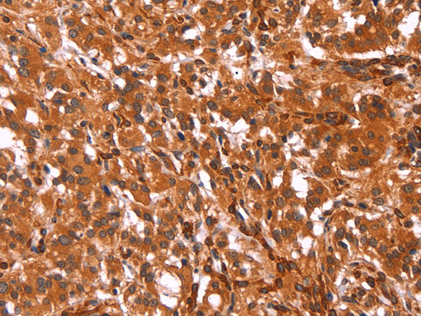 兔抗gcgglicentin多克隆抗体anti Gcg Rabbit Polyclonal Antibody 生命科学产品与技术服务 生