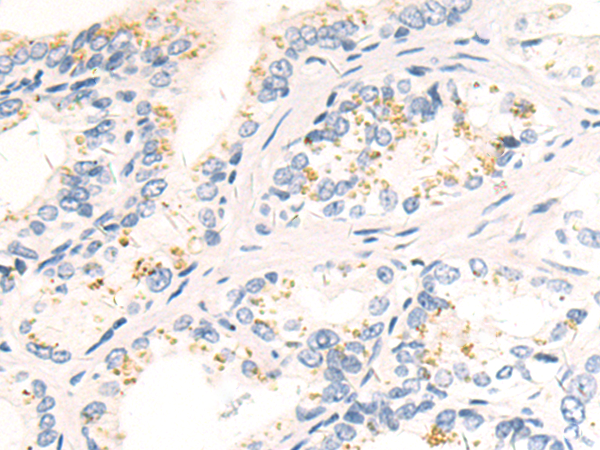 兔抗GCGR多克隆抗体,Anti-GCGR rabbit polyclonal antibody 生命科学产品与技术服务-生工生物工程(上海 ...
