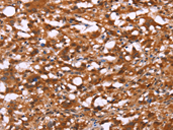 兔抗BRK1多克隆抗体,Anti-BRK1 rabbit polyclonal antibody 生命科学产品与技术服务-生工生物工程(上海 ...