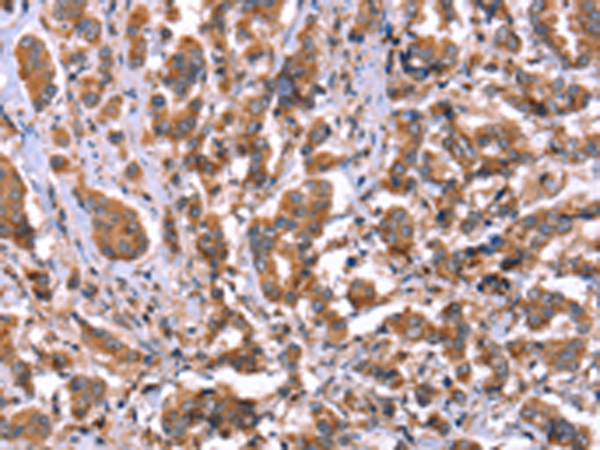 兔抗hrg多克隆抗体anti Hrg Rabbit Polyclonal Antibody 生命科学产品与技术服务 生工生物工程上海股份有限公司