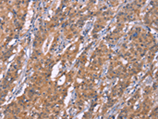 兔抗plaat2多克隆抗体anti Plaat2 Rabbit Polyclonal Antibody 生命科学产品与技术服务 生工生物工程