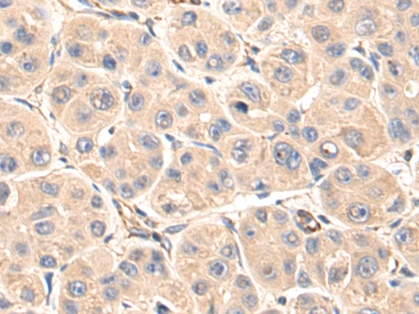 兔抗mgll多克隆抗体anti Mgll Rabbit Polyclonal Antibody 生命科学产品与技术服务 生工生物工程上海