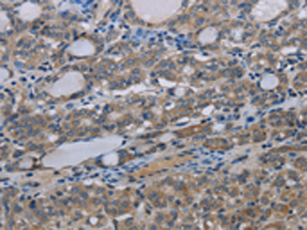 兔抗MT-ND3多克隆抗体,Anti-MT-ND3 rabbit polyclonal antibody 生命科学产品与技术服务-生工生物工程 ...