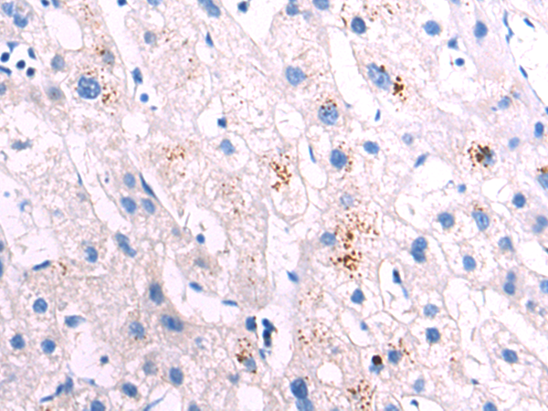 兔抗nefm多克隆抗体anti Nefm Rabbit Polyclonal Antibody 生命科学产品与技术服务 生工生物工程上海