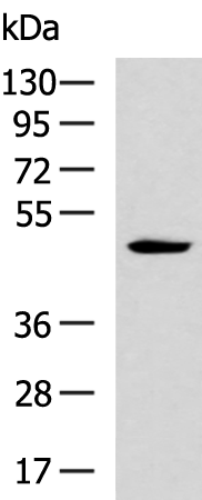 兔抗MYCN多克隆抗体,Anti-MYCN rabbit polyclonal antibody 生命科学产品与技术服务-生工生物工程(上海 ...
