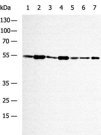 兔抗SSB多克隆抗体,Anti-SSB rabbit polyclonal antibody 生命科学产品与技术服务-生工生物工程(上海)股份有限公司