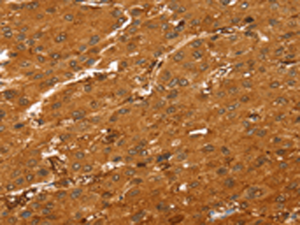 兔抗ABCC9多克隆抗体,Anti-ABCC9 rabbit polyclonal antibody 生命科学产品与技术服务-生工生物工程 ...