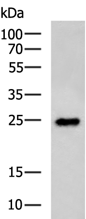 兔抗CLDN18多克隆抗体,Anti-CLDN18 rabbit polyclonal antibody 生命科学产品与技术服务-生工生物工程 ...