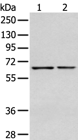 兔抗GPC1多克隆抗体,Anti-GPC1 rabbit polyclonal antibody 生命科学产品与技术服务-生工生物工程(上海 ...