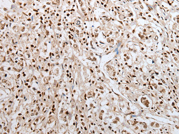 兔抗NRG1多克隆抗体,Anti-NRG1 rabbit polyclonal antibody 生命科学产品与技术服务-生工生物工程(上海)股份有限公司