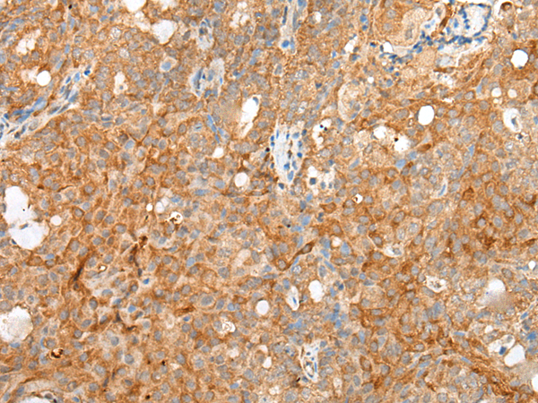 兔抗SDC2多克隆抗体,Anti-SDC2 rabbit polyclonal antibody 生命科学产品与技术服务-生工生物工程(上海)股份有限公司