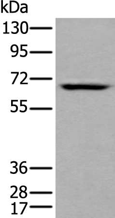 兔抗LILRB5多克隆抗体,Anti-LILRB5 rabbit polyclonal antibody 生命科学产品与技术服务-生工生物工程 ...