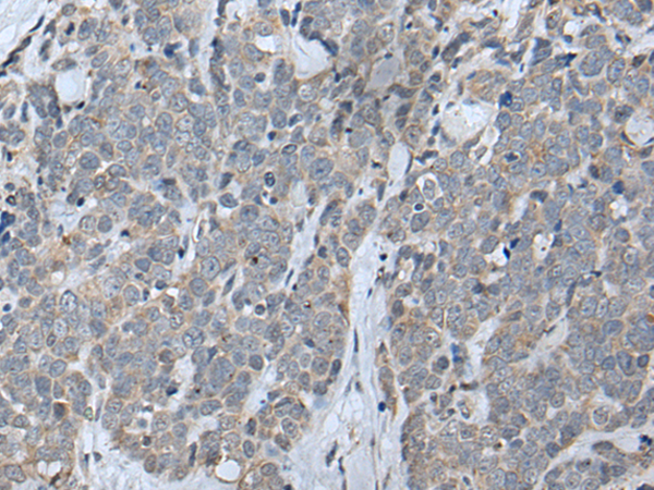 兔抗JAK3多克隆抗体,Anti-JAK3 rabbit polyclonal antibody 生命科学产品与技术服务-生工生物工程(上海 ...