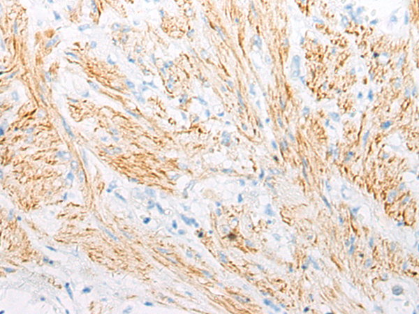 兔抗ghrh多克隆抗体anti Ghrh Rabbit Polyclonal Antibody 生命科学产品与技术服务 生工生物工程上海