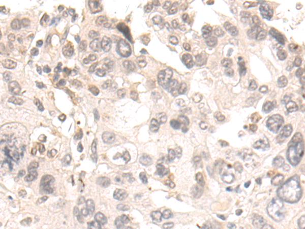 兔抗alx4多克隆抗体anti Alx4 Rabbit Polyclonal Antibody 生命科学产品与技术服务 生工生物工程上海