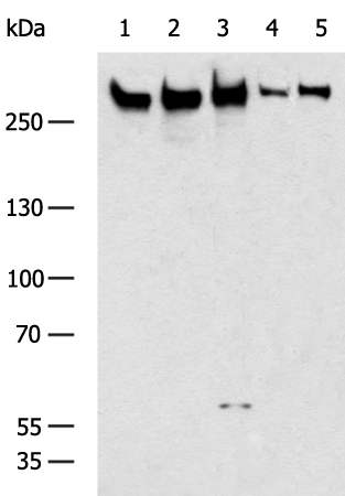 兔抗FLNC多克隆抗体,Anti-FLNC rabbit polyclonal antibody 生命科学产品与技术服务-生工生物工程(上海 ...