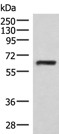 兔抗RNF217多克隆抗体,Anti-RNF217 rabbit polyclonal antibody 生命科学产品与技术服务-生工生物工程 ...