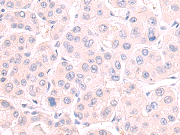 兔抗il10多克隆抗体anti Il10 Rabbit Polyclonal Antibody 生命科学产品与技术服务 生工生物工程上海