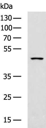兔抗Rh5多克隆抗体,Anti-Rh5 rabbit polyclonal antibody 生命科学产品与技术服务-生工生物工程(上海)股份有限公司