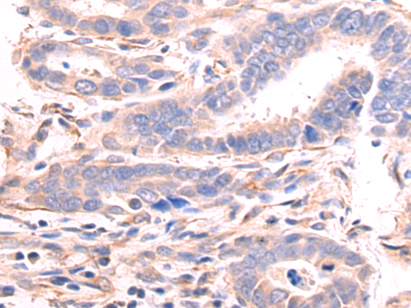 兔抗ASAP2多克隆抗体,Anti-ASAP2 rabbit polyclonal antibody 生命科学产品与技术服务-生工生物工程 ...