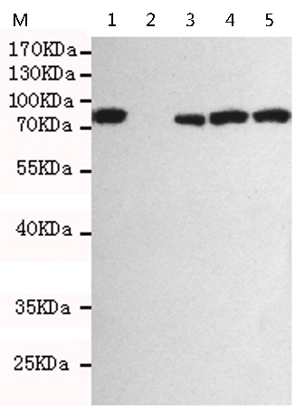 小鼠抗BTK单克隆抗体,Anti-BTK mouse monoclonal antibody 生命科学产品与技术服务-生工生物工程(上海)股份有限公司