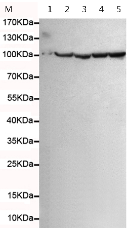 小鼠抗EEF2单克隆抗体,Anti-EEF2 mouse monoclonal antibody 生命科学产品与技术服务-生工生物工程(上海 ...