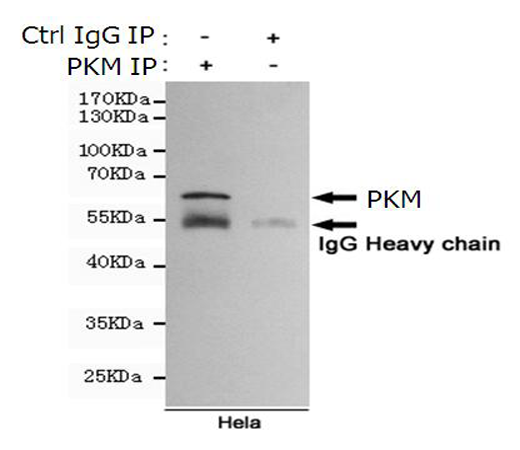小鼠抗PKM单克隆抗体,Anti-PKM mouse monoclonal antibody 生命科学产品与技术服务-生工生物工程(上海)股份有限公司