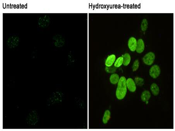 小鼠抗H2AX（phospho-Ser139）单克隆抗体,Anti-H2AX (phospho-Ser139) mouse ...