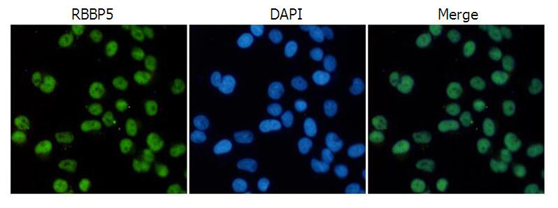 小鼠抗RBBP5单克隆抗体,Anti-RBBP5 mouse monoclonal antibody 生命科学产品与技术服务-生工生物工程 ...