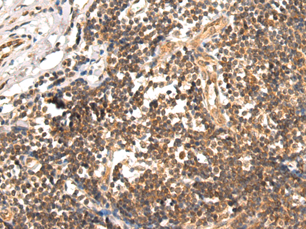 小鼠抗STAT3单克隆抗体,Anti-STAT3 mouse monoclonal antibody 生命科学产品与技术服务-生工生物工程 ...