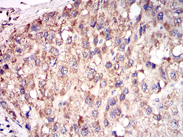 小鼠抗ACP5单克隆抗体,Anti-ACP5 mouse monoclonal antibody 生命科学产品与技术服务-生工生物工程(上海 ...