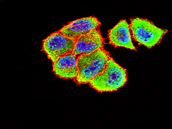 小鼠抗ALPG单克隆抗体,Anti-ALPG mouse monoclonal antibody 生命科学产品与技术服务-生工生物工程(上海 ...