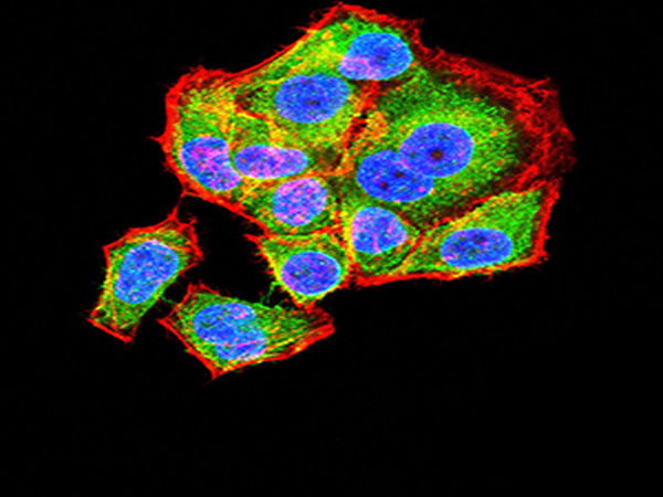 小鼠抗CEACAM6单克隆抗体,Anti-CEACAM6 mouse monoclonal antibody 生命科学产品与技术服务-生工生物 ...