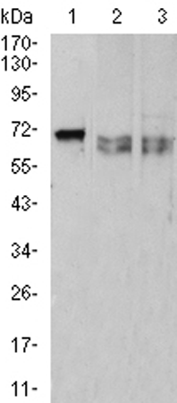 小鼠抗GP1BA单克隆抗体,Anti-GP1BA mouse monoclonal antibody 生命科学产品与技术服务-生工生物工程 ...