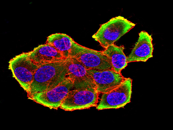 小鼠抗VCP单克隆抗体,Anti-VCP mouse monoclonal antibody 生命科学产品与技术服务-生工生物工程(上海)股份有限公司