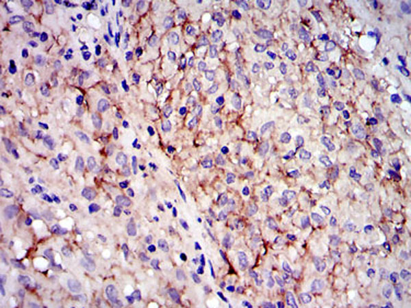 小鼠抗KIT单克隆抗体,Anti-KIT mouse monoclonal antibody 生命科学产品与技术服务-生工生物工程(上海)股份有限公司