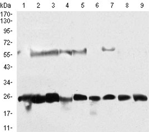 小鼠抗CSNK2B单克隆抗体,Anti-CSNK2B mouse monoclonal antibody 生命科学产品与技术服务-生工生物工程 ...