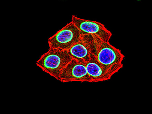 小鼠抗LMNB1单克隆抗体,Anti-LMNB1 mouse monoclonal antibody 生命科学产品与技术服务-生工生物工程 ...