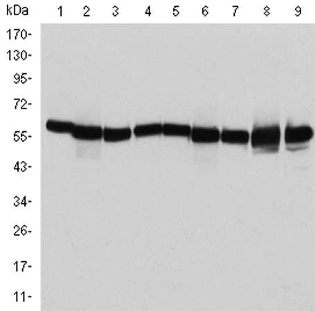小鼠抗HSPD1单克隆抗体,Anti-HSPD1 mouse monoclonal antibody 生命科学产品与技术服务-生工生物工程 ...
