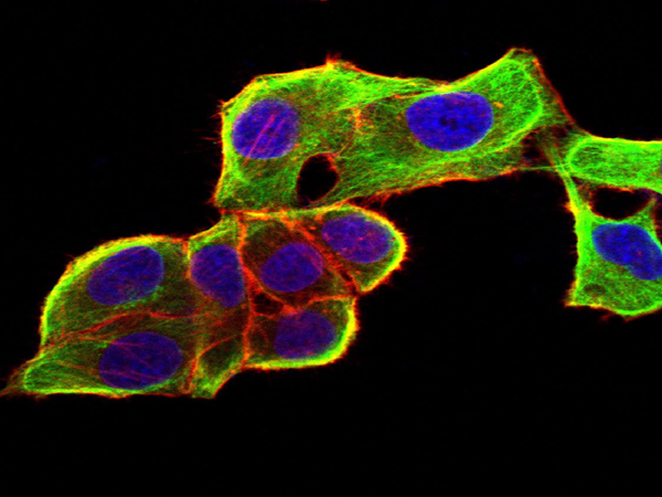 小鼠抗TUBB单克隆抗体,Anti-TUBB mouse monoclonal antibody 生命科学产品与技术服务-生工生物工程(上海 ...