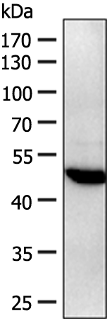 小鼠抗VTN单克隆抗体,Anti-VTN mouse monoclonal antibody 生命科学产品与技术服务-生工生物工程(上海)股份有限公司