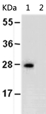 小鼠抗HRAS/KRAS/NRAS (mutated Q61R)单克隆抗体,Anti-HRAS/KRAS/NRAS (mutated Q61R ...