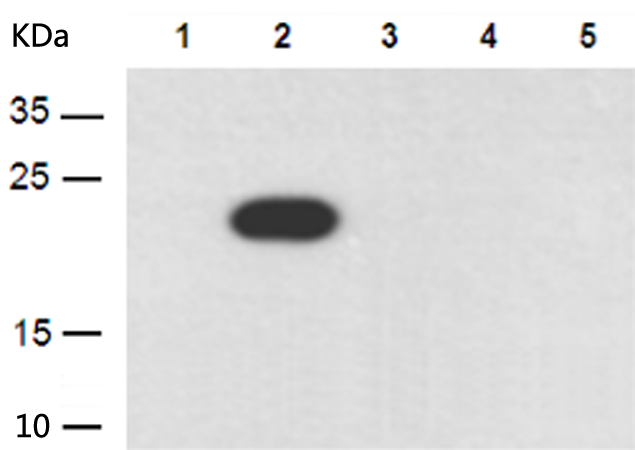 小鼠抗HRAS/KRAS/NRAS (mutated Q61L)单克隆抗体,Anti-HRAS/KRAS/NRAS (mutated Q61L ...