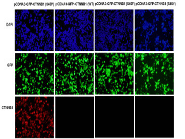 小鼠抗CTNNB1 (mutated S45P)单克隆抗体,Anti-CTNNB1 (mutated S45P) mouse ...