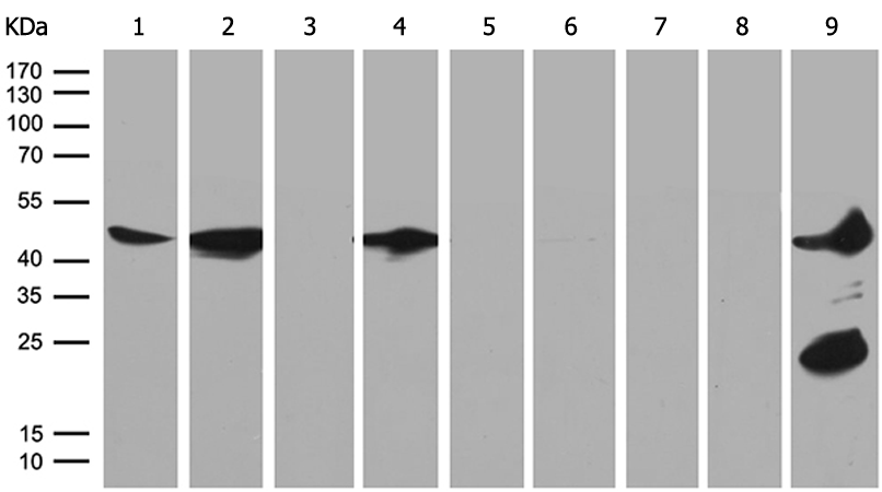 小鼠抗ASS1单克隆抗体,Anti-ASS1 mouse monoclonal antibody 生命科学产品与技术服务-生工生物工程(上海 ...