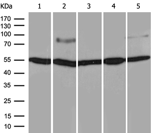 小鼠抗TCF12单克隆抗体,Anti-TCF12 mouse monoclonal antibody 生命科学产品与技术服务-生工生物工程 ...