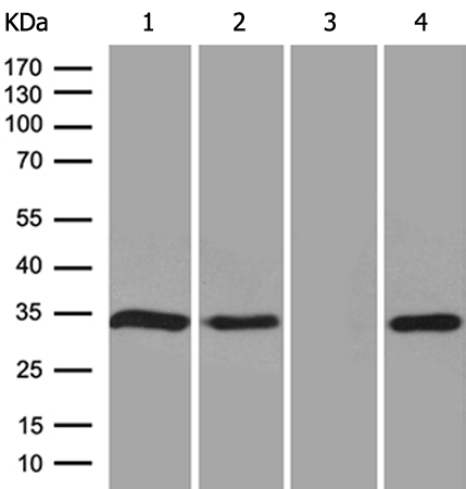 小鼠抗NAT1单克隆抗体,Anti-NAT1 mouse monoclonal antibody 生命科学产品与技术服务-生工生物工程(上海 ...