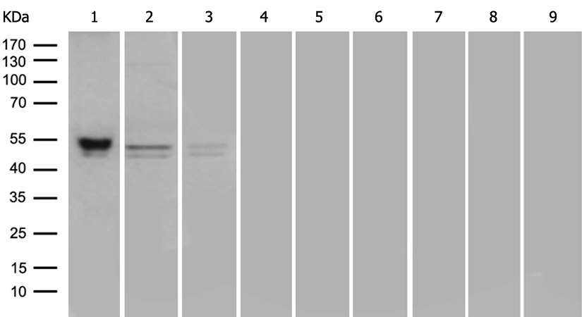 小鼠抗CD274单克隆抗体,Anti-CD274 mouse monoclonal antibody 生命科学产品与技术服务-生工生物工程 ...