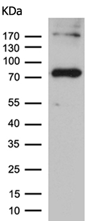 小鼠抗ACSL5单克隆抗体,Anti-ACSL5 mouse monoclonal antibody 生命科学产品与技术服务-生工生物工程 ...