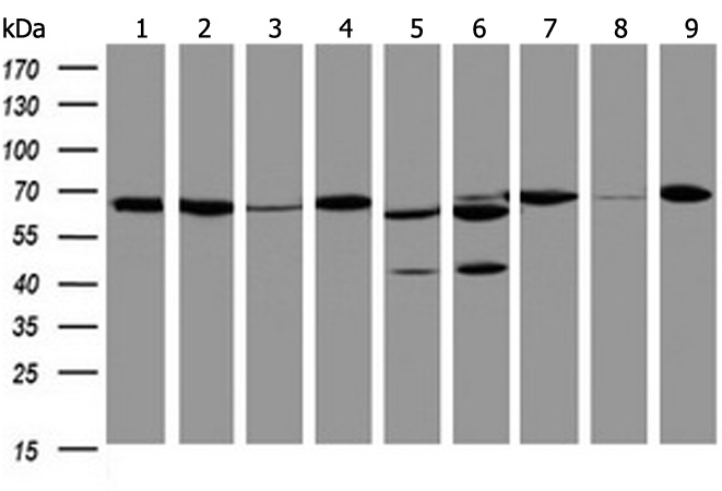 小鼠抗HSPD1单克隆抗体,Anti-HSPD1 mouse monoclonal antibody 生命科学产品与技术服务-生工生物工程 ...